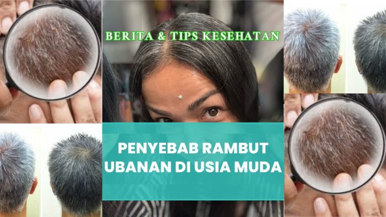 Penyebab Rambut Beruban di Usia Muda dan Solusinya