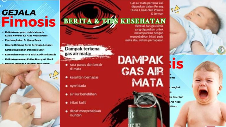 Sunat Dini Bayi dan Risiko Fimosis yang Perlu Moms Tahu